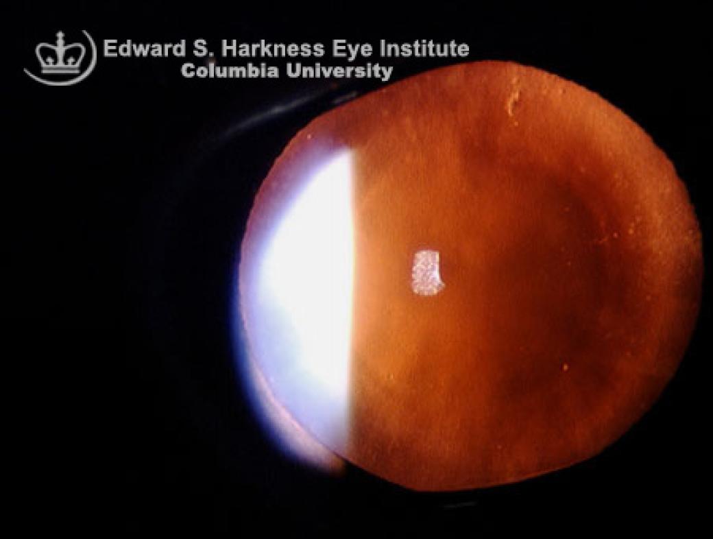 Oil Droplet | Vagelos College of Physicians and Surgeons