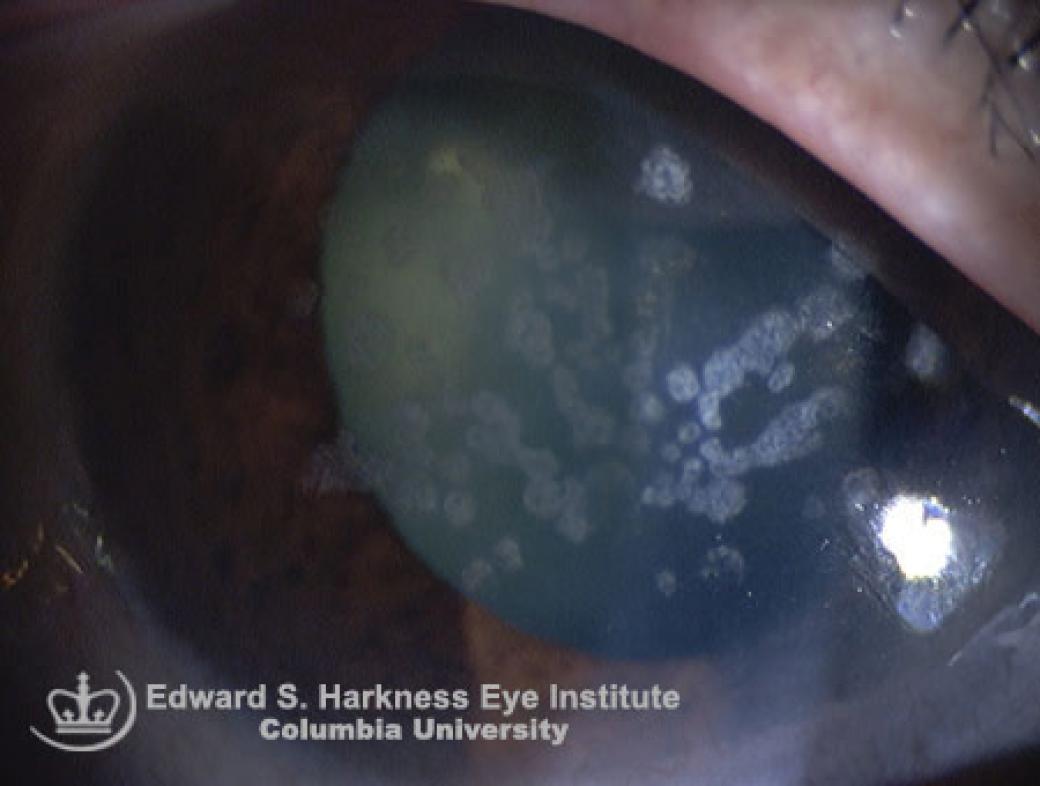 Granular | Vagelos College of Physicians and Surgeons