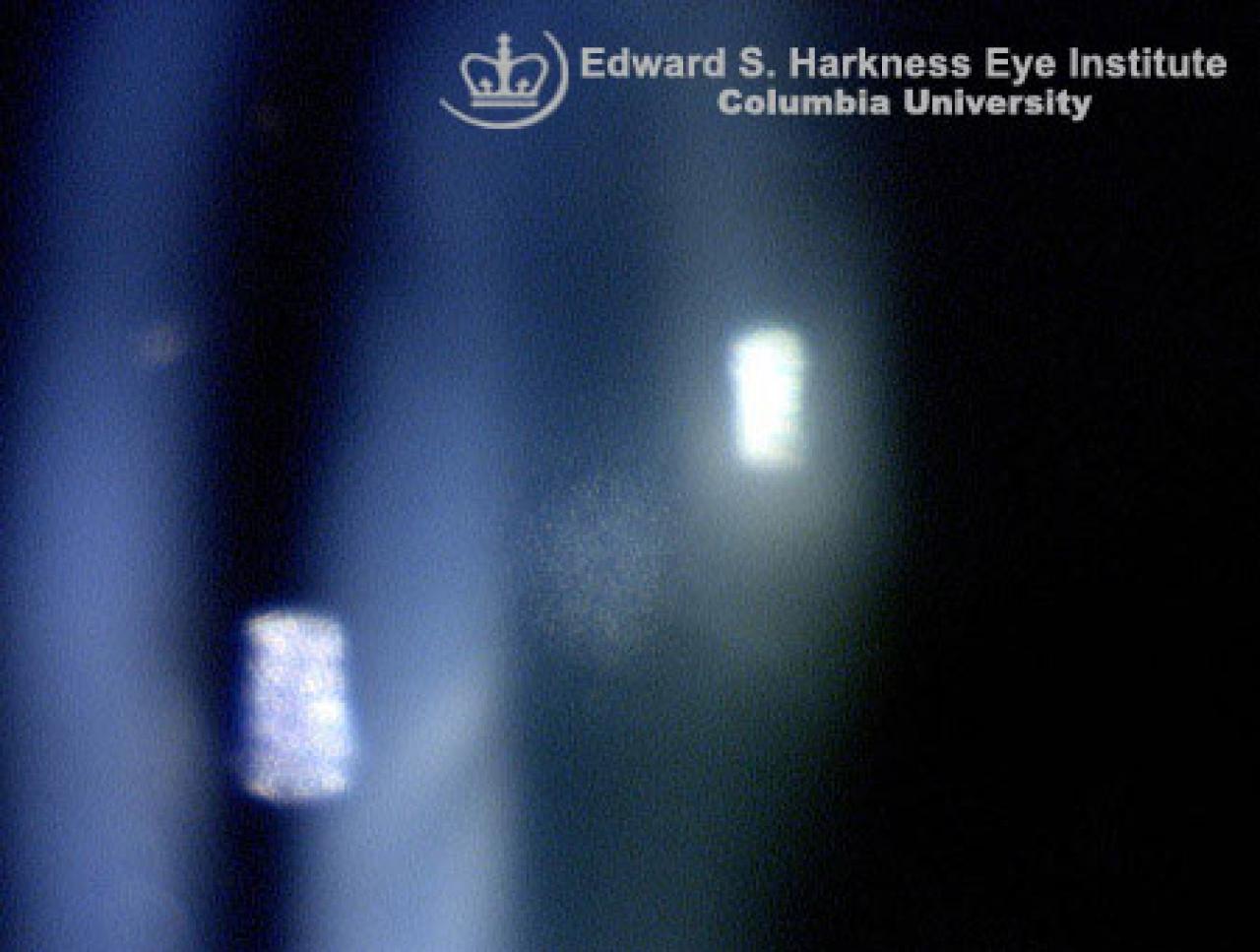 Fetal Nuclear | Vagelos College of Physicians and Surgeons