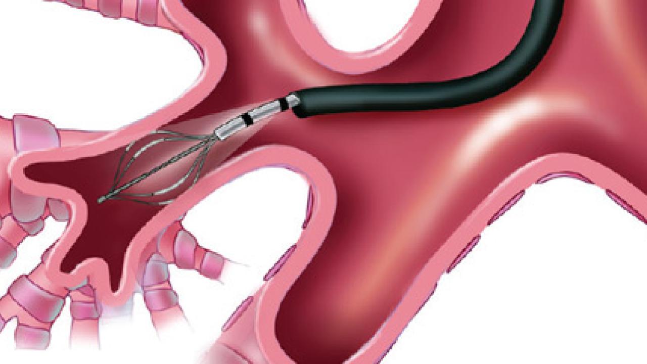 Clinical Advances | Vagelos College of Physicians and Surgeons