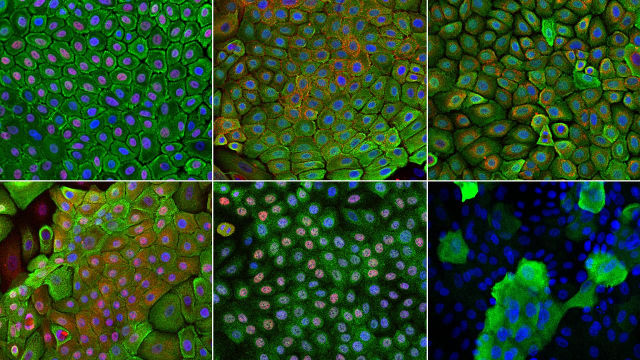 Internal Funding Opportunities | Vagelos College of Physicians and Surgeons