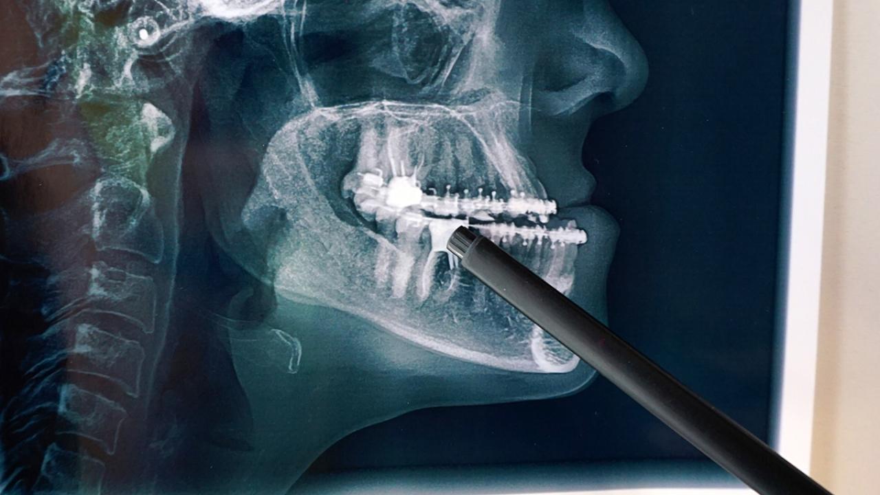 Oral And Maxillofacial Surgery Residency Program Vagelos College Of