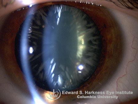 Cortical | Vagelos College of Physicians and Surgeons