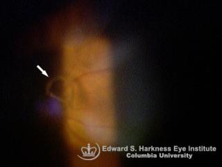 Weiss Ring | Vagelos College of Physicians and Surgeons