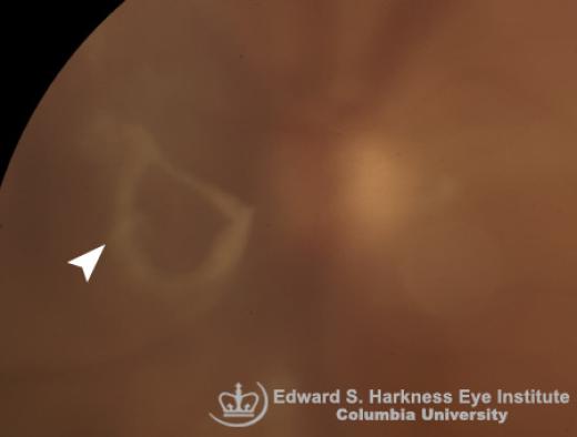 Weiss Ring | Vagelos College of Physicians and Surgeons