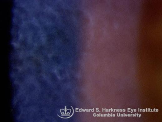 Thiel-Behnke | Vagelos College of Physicians and Surgeons