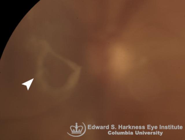 Weiss Ring | Vagelos College of Physicians and Surgeons