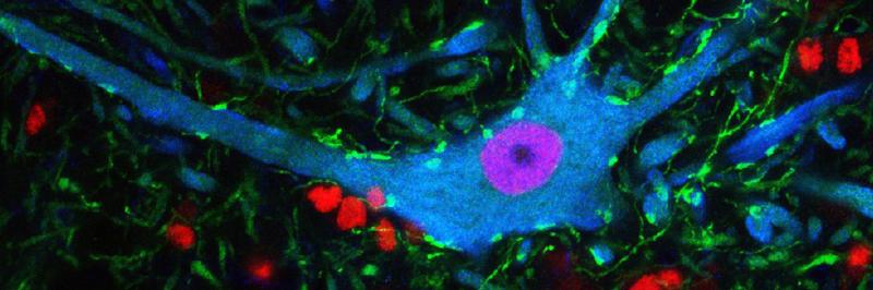 About Motor Neuron Diseases | Vagelos College of Physicians and Surgeons